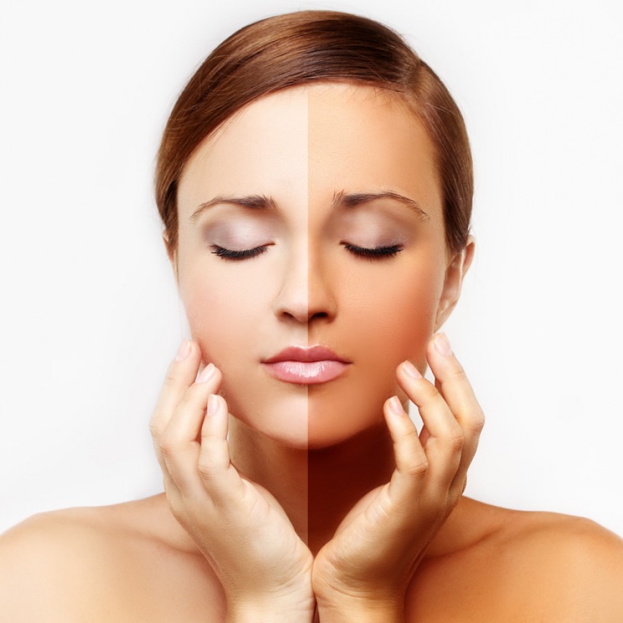 SensiQuin Skin whitening Cream with U.V filter 50 ml